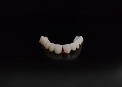 China Customizable Ceramic Dental Prostheses Tailored to Meet Specific Dental Restoration Requirements and Patient Preferences for sale