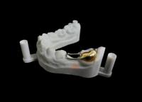 China Safe Pediatric Dental Space Maintainers Manufactured to Maintain Tooth Alignment and Prevent Early Tooth Loss Complications for sale