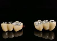 China High Strength Porcelain Fused To Metal Crown Suitable For Dental Applications Requiring Both Durability And Beauty for sale