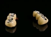 China High Strength Porcelain Fused To Metal Crown Suitable For Dental Applications Requiring Both Durability And Beauty for sale