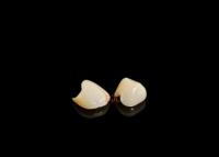China Durable Emax Pressed Veneer Ideal for Dental Restoration Applications Offering Precision Fit and Long Lasting Strength for sale