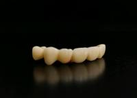 China Esthetic Zirconia Dental Bridge Featuring High Translucency and Robust Structure Perfect for Dental Restoration Projects for sale