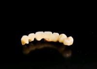 China Esthetic Zirconia Dental Bridge Featuring High Translucency and Robust Structure Perfect for Dental Restoration Projects for sale