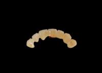 China Esthetic Zirconia Dental Bridge Featuring High Translucency and Robust Structure Perfect for Dental Restoration Projects for sale