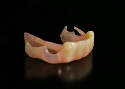 China Flexible Partial Denture Prosthesis made from flexible nylon material offering superior comfort natural look and durability for sale