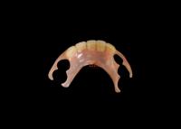 China Flexible Partial Denture Prosthesis made from flexible nylon material offering superior comfort natural look and durability for sale