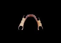 China Comfortable Lightweight Flexible Partial Denture Durable Removable Dental Prosthesis Ideal For Partial Tooth Restoration for sale