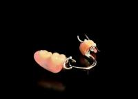China Precision Metal Removable Partial Dentures Engineered for Accurate Fit and Performance in Dental Restoration Procedures for sale