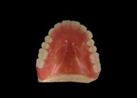 China Comfortable Complete Acrylic Denture Offering Secure Fit Long Lasting Strength and Natural Appearance for Dental Clinics for sale