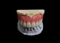China Comfortable Complete Acrylic Denture Offering Secure Fit Long Lasting Strength and Natural Appearance for Dental Clinics for sale