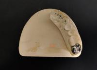 China Precision Porcelain Fused To Metal Crown Engineered For Superior Strength And Natural Tooth Color Matching In Dentistry for sale