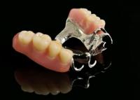 China Flexible Metal Partial Denture Removable Dental Prosthesis Designed To Ensure Optimal Fit And Easy Maintenance For Daily for sale