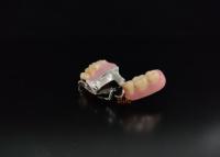 China Flexible Metal Partial Denture Removable Dental Prosthesis Designed To Ensure Optimal Fit And Easy Maintenance For Daily for sale