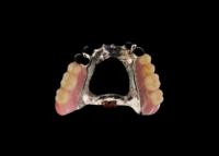 China Flexible Metal Partial Denture Removable Dental Prosthesis Designed To Ensure Optimal Fit And Easy Maintenance For Daily for sale