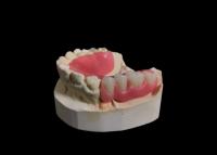 China Durable Flexible Removable Partial Dentures Providing Comfortable Fit Lightweight Design and Easy Adjustment for Dental Practices for sale