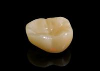 China Durable Ceramic Dental Prosthetics Designed to Meet Exacting Standards Providing Consistent and Patient Satisfaction for sale