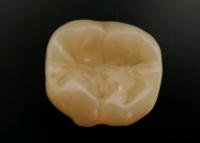 China Durable Ceramic Dental Prosthetics Designed to Meet Exacting Standards Providing Consistent and Patient Satisfaction for sale