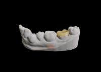 China Durable Ceramic Dental Prosthetics Designed to Meet Exacting Standards Providing Consistent and Patient Satisfaction for sale