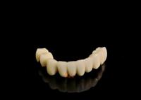 China Durable Metal Bonded Porcelain Crown Offering Long Lasting Strength and Natural Appearance Ideal for Dental Restorations for sale