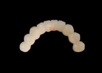 China Durable Metal Bonded Porcelain Crown Offering Long Lasting Strength and Natural Appearance Ideal for Dental Restorations for sale