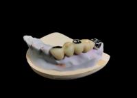 China Durable Porcelain Fused To Metal Crown Engineered For Optimal Fit And Longevity Supporting Dental Clinics And Laboratories for sale