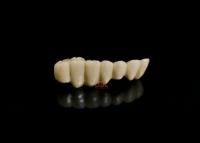 China Custom Porcelain Fused To Metal Restorations Offering Superior Strength and Natural Appearance for Optimal Dental Outcomes for sale