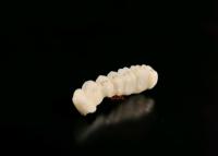 China Custom Porcelain Fused To Metal Restorations Offering Superior Strength and Natural Appearance for Optimal Dental Outcomes for sale