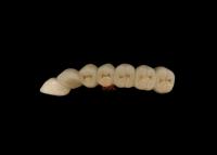 China Custom Porcelain Fused To Metal Restorations Offering Superior Strength and Natural Appearance for Optimal Dental Outcomes for sale