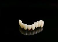 China Long Lasting Ceramic Dental Prosthetics Combining Strength Aesthetic Appeal and Comfortable Wear for Dental Professionals for sale