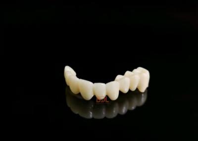 China Long Lasting Ceramic Dental Prosthetics Combining Strength Aesthetic Appeal and Comfortable Wear for Dental Professionals for sale