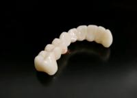 China Long Lasting Ceramic Dental Prosthetics Combining Strength Aesthetic Appeal and Comfortable Wear for Dental Professionals for sale
