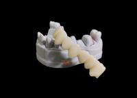 China Long Lasting Ceramic Dental Prosthetics Combining Strength Aesthetic Appeal and Comfortable Wear for Dental Professionals for sale