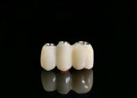 China Corrosion Resistant Dental Implant Support Bar Manufactured with Precision to Ensure Secure Implant Prosthesis Attachment for sale