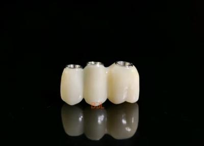 China Corrosion Resistant Dental Implant Support Bar Manufactured with Precision to Ensure Secure Implant Prosthesis Attachment for sale