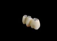 China Corrosion Resistant Dental Implant Support Bar Manufactured with Precision to Ensure Secure Implant Prosthesis Attachment for sale