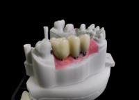 China Corrosion Resistant Dental Implant Support Bar Manufactured with Precision to Ensure Secure Implant Prosthesis Attachment for sale