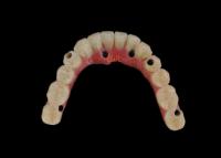 China Durable Corrosion Resistant Dental Implant Support Bar Made from Titanium Alloy Designed to Provide Support and Longevity for sale
