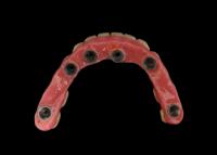 China Durable Corrosion Resistant Dental Implant Support Bar Made from Titanium Alloy Designed to Provide Support and Longevity for sale