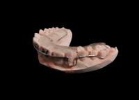 China Custom Fit Transparent Dental Orthodontic Retainers Engineered for Effective Post Braces Teeth Stabilization and Comfort for sale