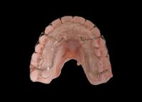 China Custom Fit Transparent Dental Orthodontic Retainers Engineered for Effective Post Braces Teeth Stabilization and Comfort for sale