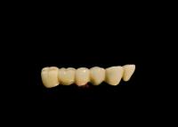 China Precision Fit Porcelain Fused To Metal Crown Providing Enhanced Strength And Natural Tooth Color For Dental Applications for sale