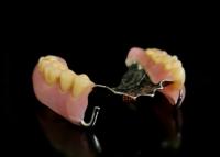 China Biocompatible Metal Framework Partial Dentures manufactured to meet stringent dental industry standards and patient safety for sale