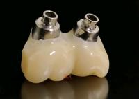 China Lightweight Implant Support Bar Offering Superior Strength and Corrosion Resistance for Dental Implant Applications for sale