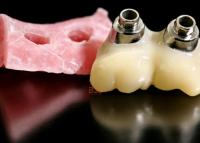 China Lightweight Implant Support Bar Offering Superior Strength and Corrosion Resistance for Dental Implant Applications for sale