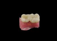 China Lightweight Implant Support Bar Offering Superior Strength and Corrosion Resistance for Dental Implant Applications for sale