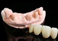 China Access control enabled Ceramic Dental Prosthetics indicating forbidden access ensuring secure and dental restoration processes for sale