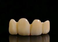 China Access control enabled Ceramic Dental Prosthetics indicating forbidden access ensuring secure and dental restoration processes for sale