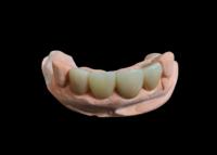 China Access control enabled Ceramic Dental Prosthetics indicating forbidden access ensuring secure and dental restoration processes for sale