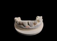 China Natural Looking Emax Dental Veneer Durable Long Lasting Esthetic Solution for Dental Clinics and Laboratories for sale