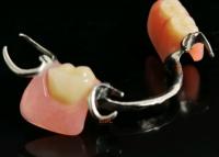 China Corrosion Resistant Metal Framework Partial Dentures providing long-term durability and function for dental laboratories for sale
